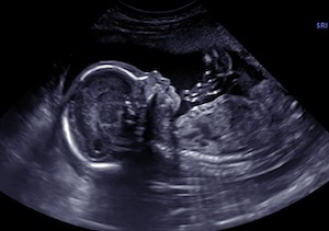 Third Trimester Pregnancy Ultrasound | Sonography | USG Test | Best in Pune